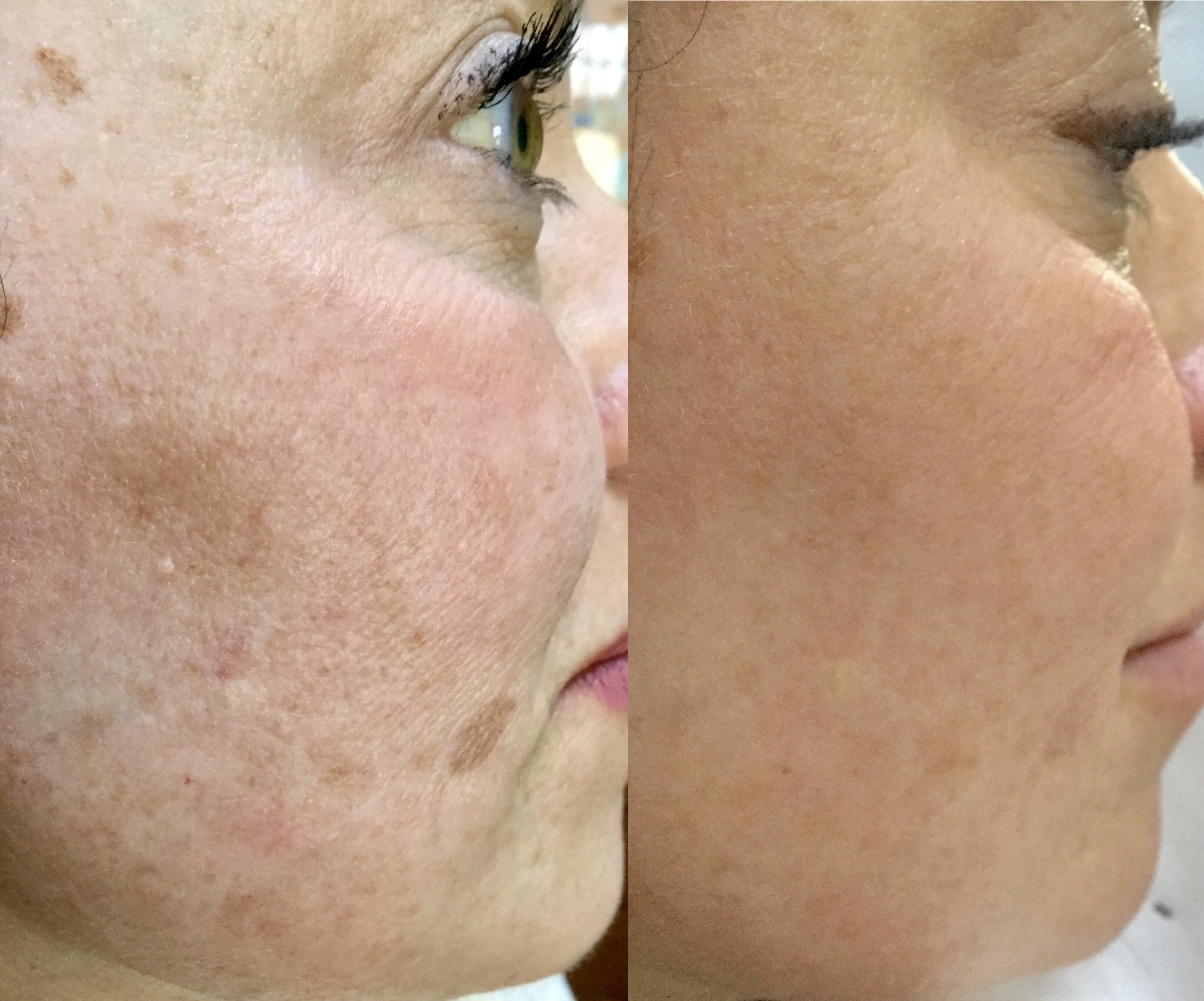 Dermatologist Cincinnati – Dr. Porras Skin Diagnostics Laser and ...